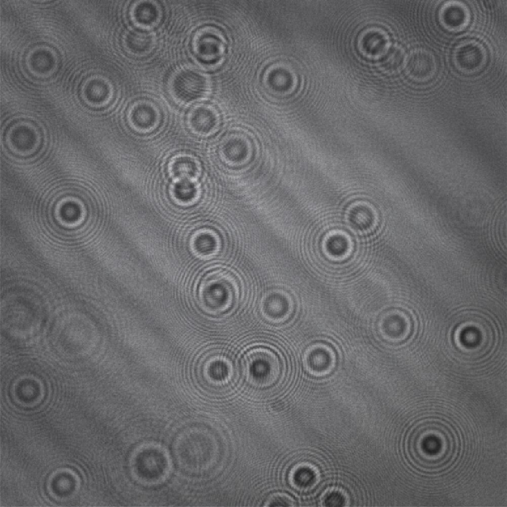 Urine microscopy - anvajo